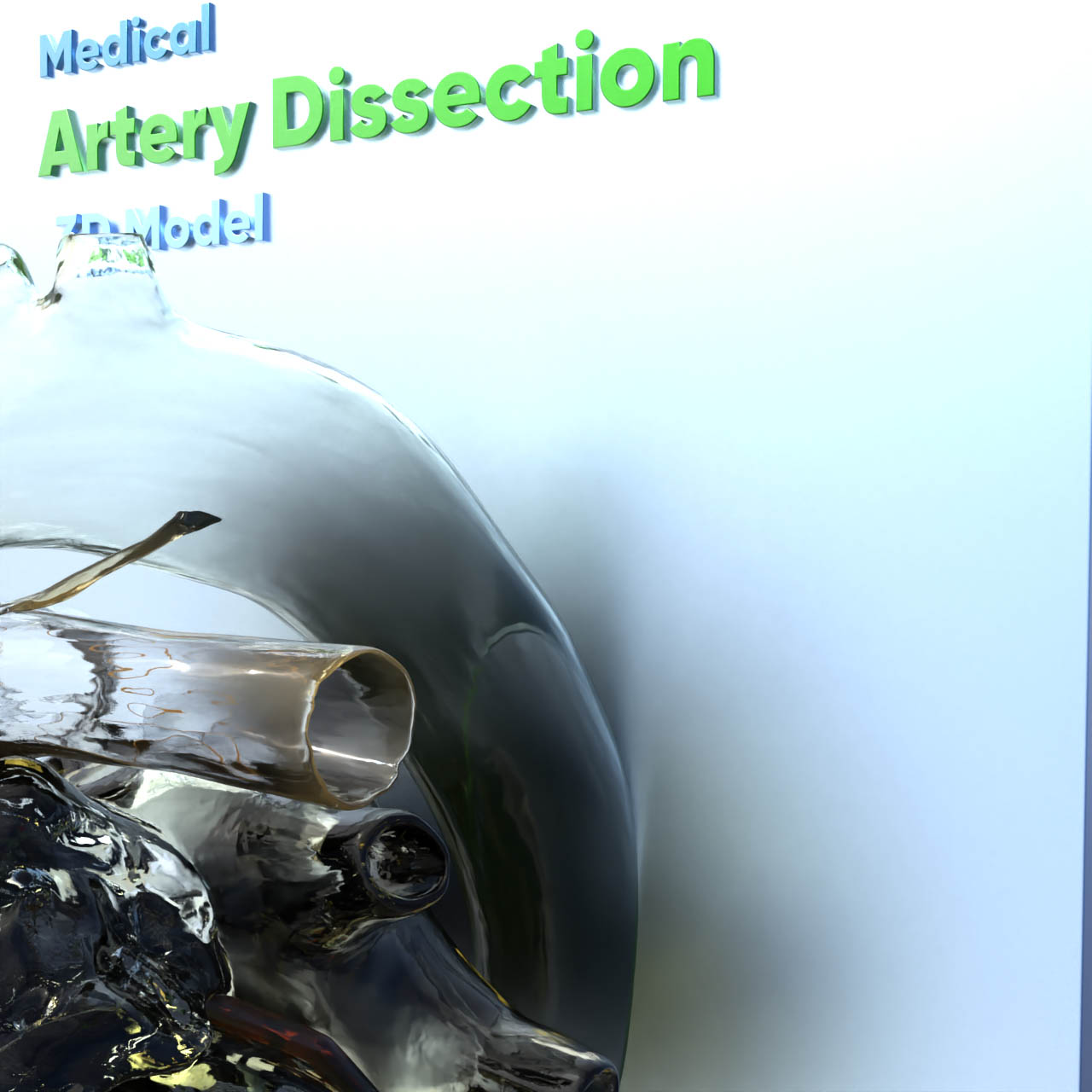 MV Artery Dissection Medical Cardiovascular 3D Model - 2D 3D Resources